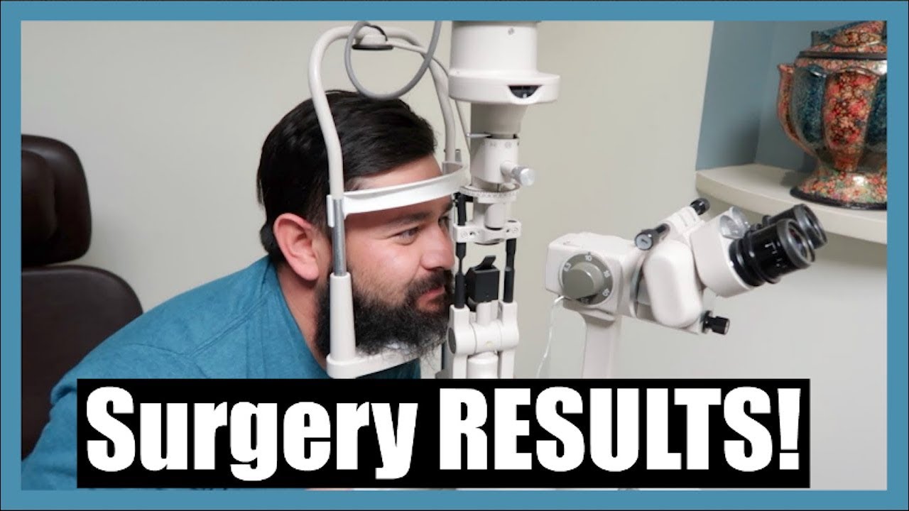 Eye Surgery Post Op + Results! Keratoconus | April 27, 2018 - YouTube