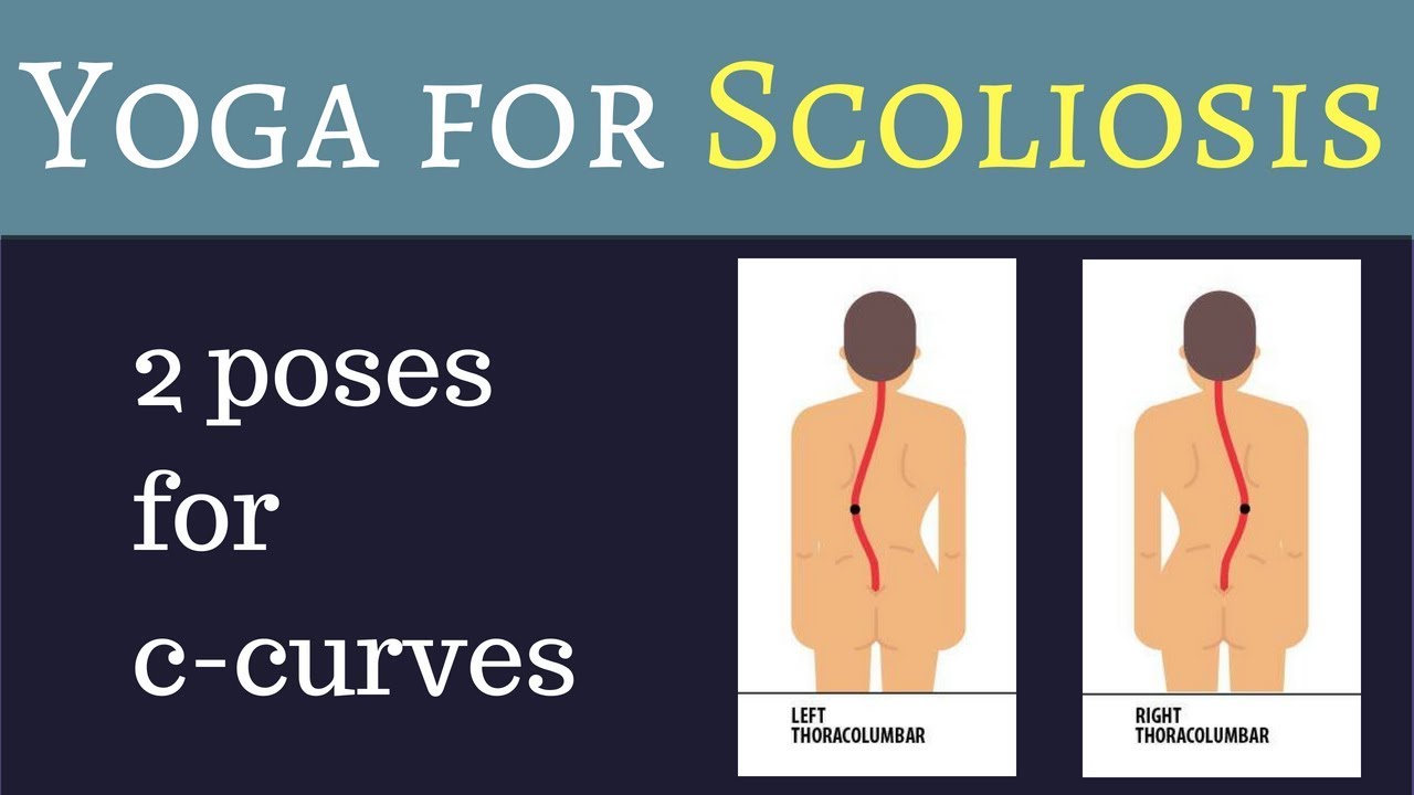 Two Exercises For C curve Scoliosis thoracolumbar YouTube