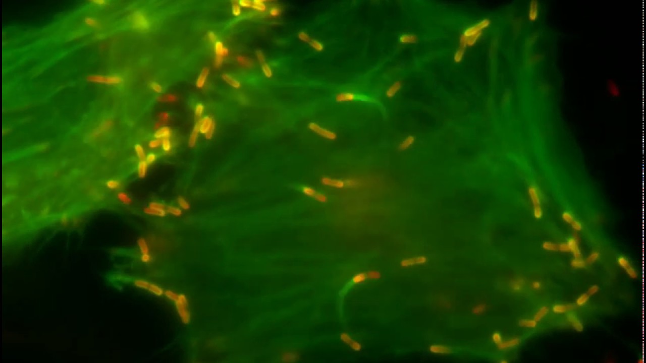 Listeria infecting human cells 2! Real microscopic movie of the ...