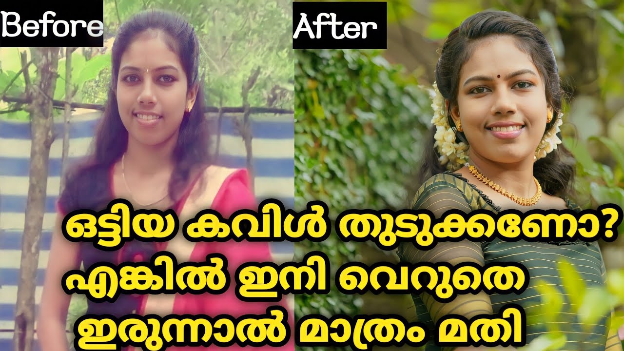 How To Get Chubby Cheeks Naturally At Home Kavil Vekkan Without how-to-get-chubby-cheeks-naturally-at-home-kavil-vekkan-without