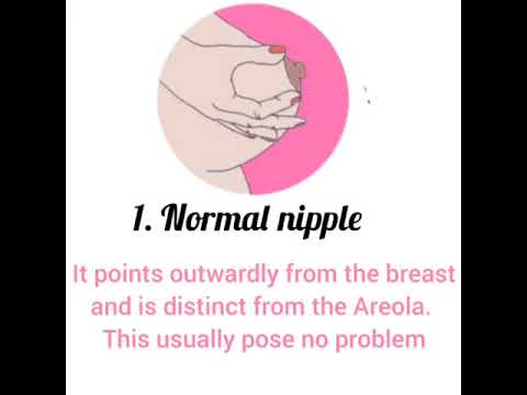 Types of Nipple