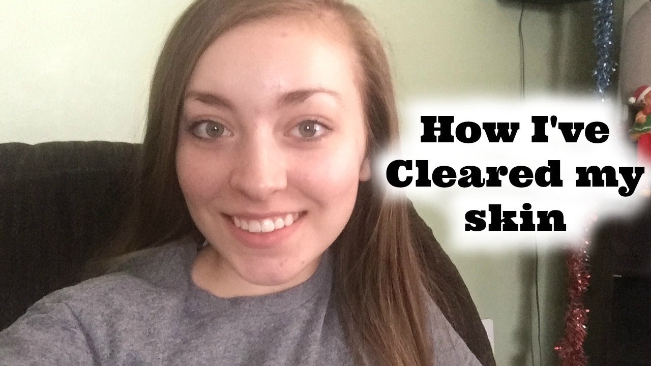 How Ive Cleared My Skin Youtube