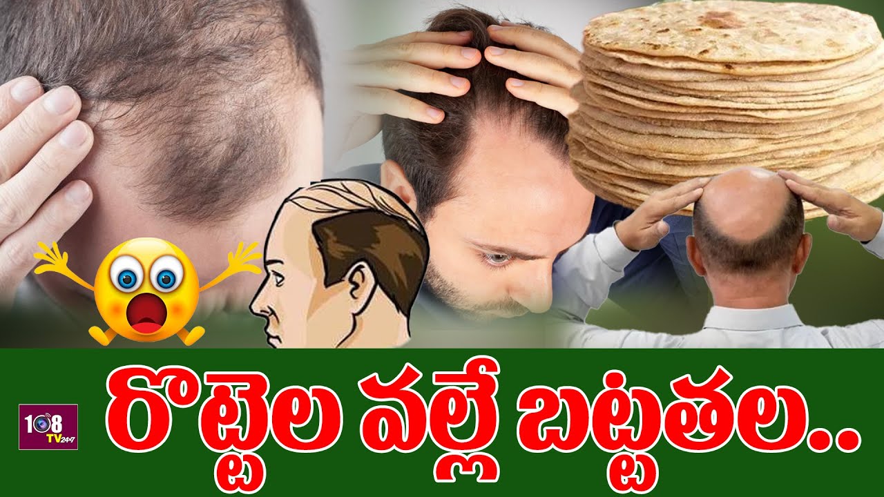 రొట్టెల వల్లే బట్టతల | Bald head due to chapati | #108tvtelugu #chapati ...