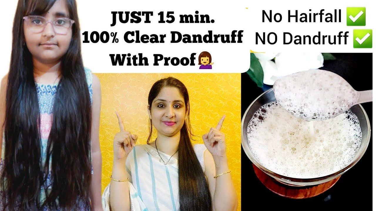 How to grow hair fast in Winters | How to treat Dandruff/Kids haircare ...
