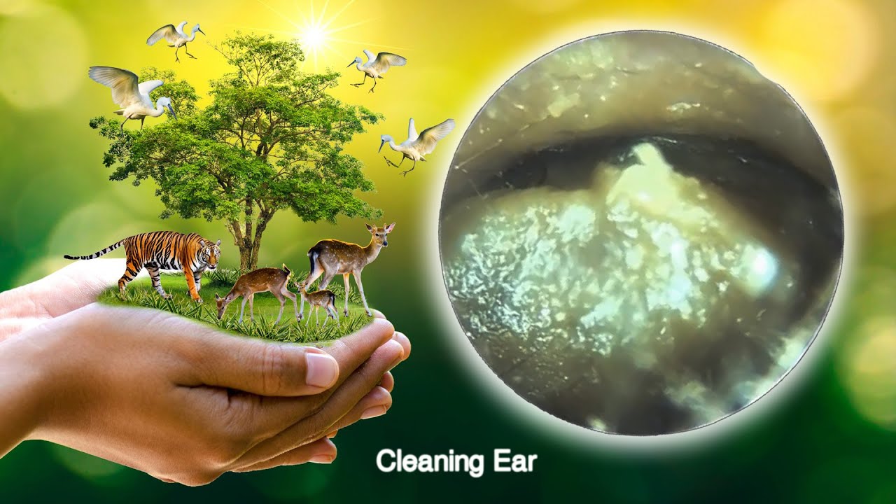 耳垢除去の痛みの ear wax removal pain reddit part 140 - YouTube