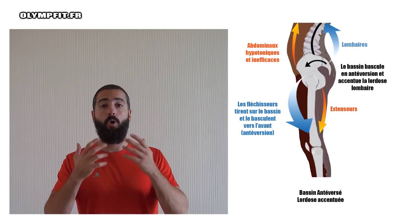 Abdominaux et Antéversion du Bassin - YouTube