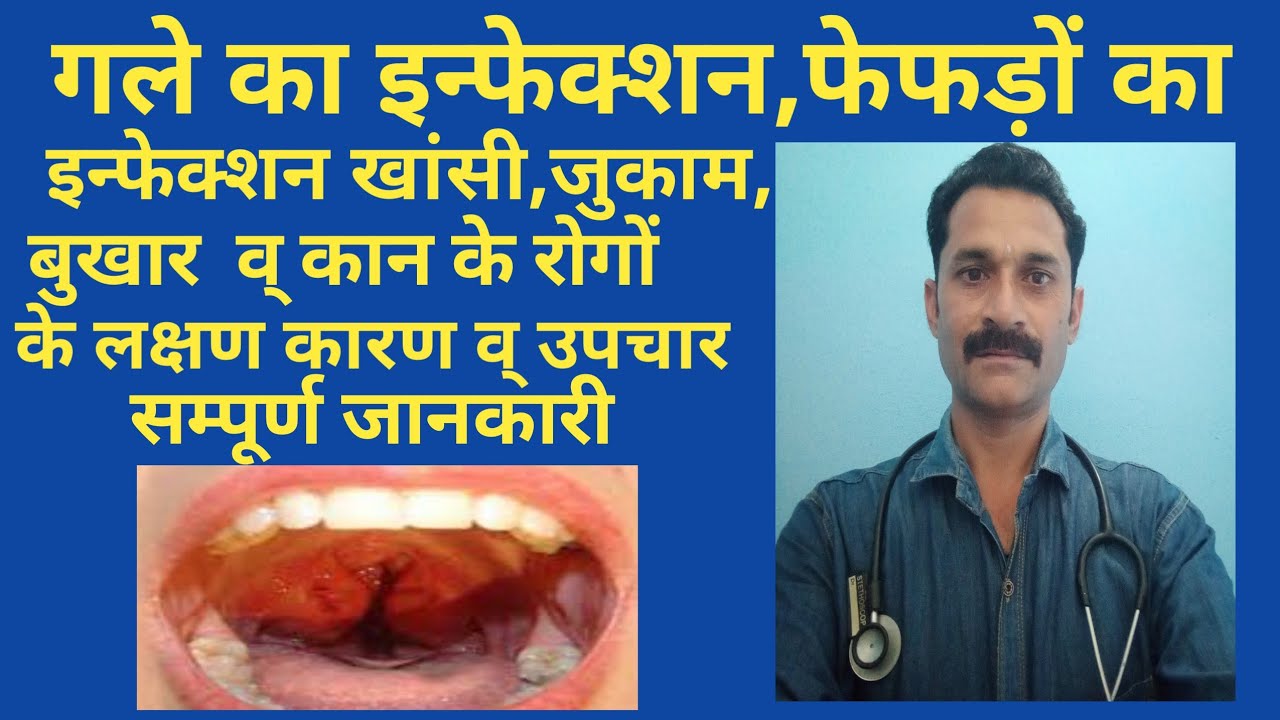 Gale Ka Infection Ka ilaj | Gale Ka Infection | MOXIKEM CV625 | Throat ...