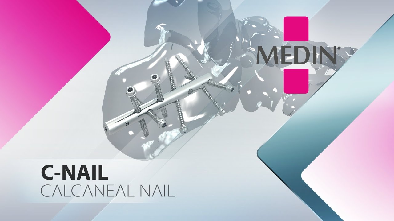 C-NAIL surgical technique (EN) - YouTube