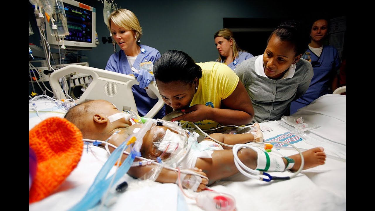 Conjoined Twins: Surgery - YouTube