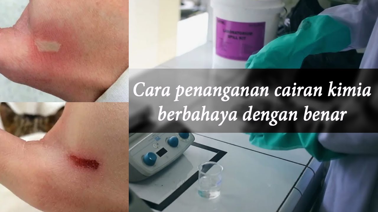 Cara membersihkan tumpahan bahan kimia berbahaya mengunakan devall ...