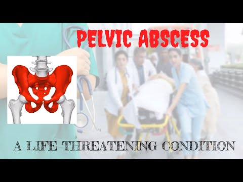 PELVIC ABSCESS - YouTube