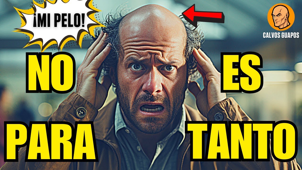 ¿Son los CALVOS MÁS GUAPOS? / ¿Por qué no TRATAR tu ALOPECIA? - YouTube