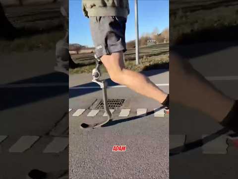 Bacağında Protez Olan Genç Hem Zeki Hem de Sevgi Dolu