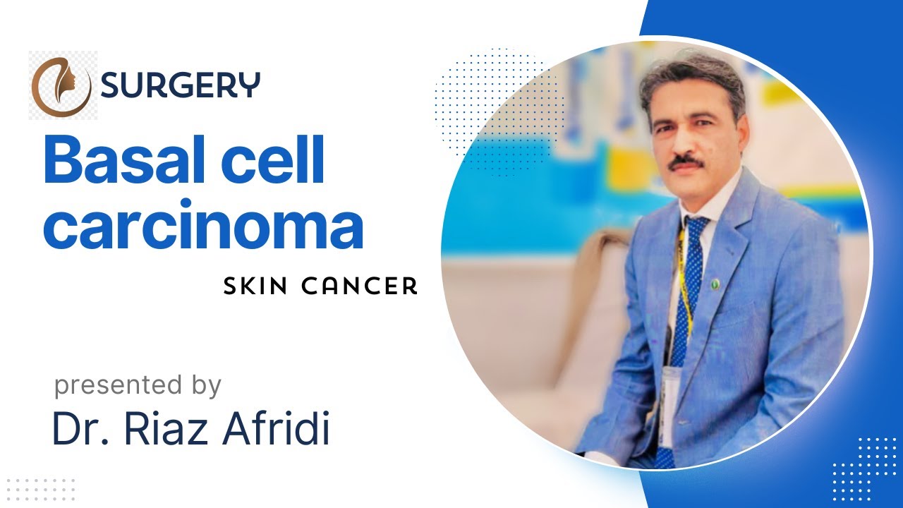 skin cancer # Basal Cell carcinoma treatment # Reconstruction # Skin ...
