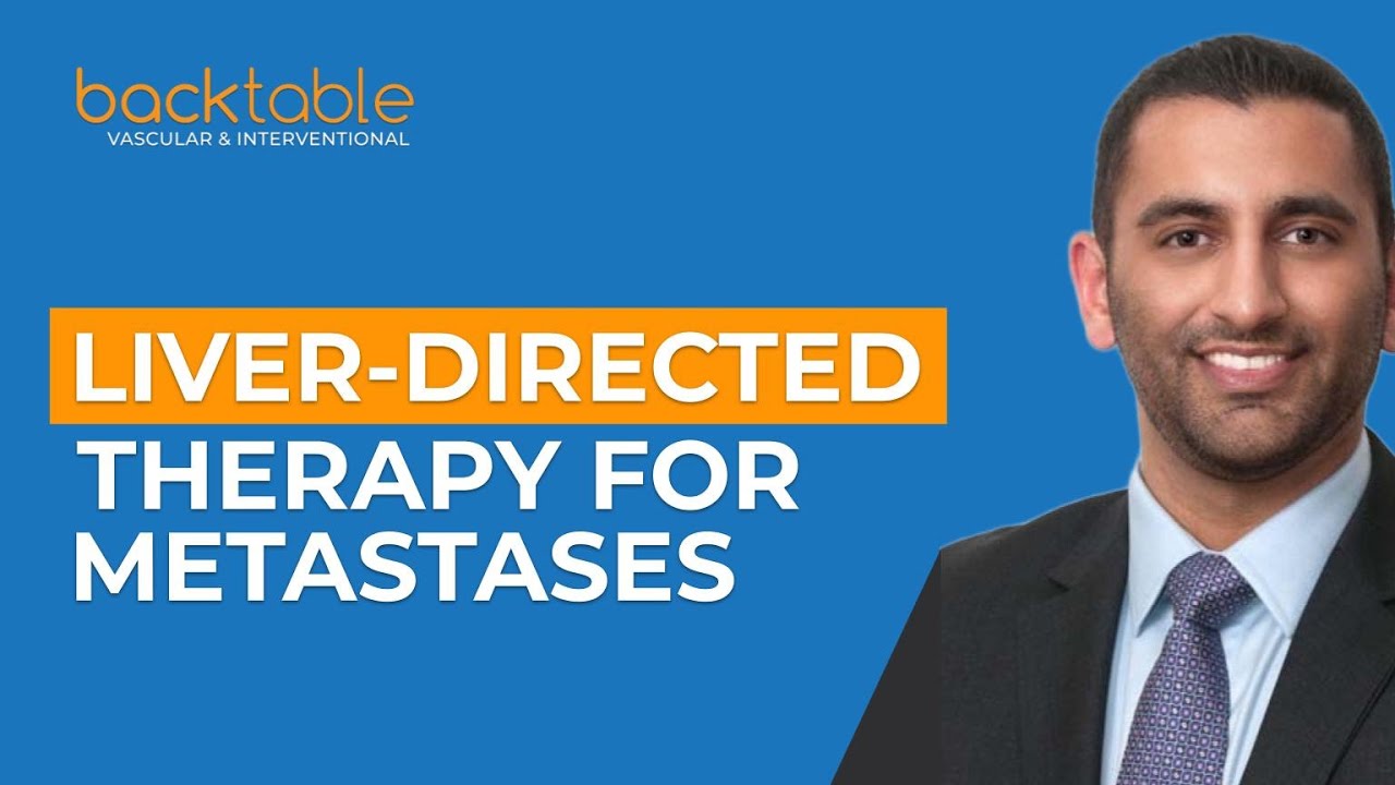 How to Choose the Right Liver-Directed Therapy for Metastases - YouTube
