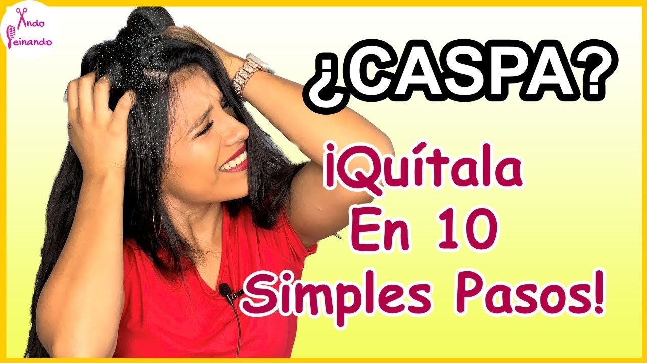 CÓMO QUITAR LA CASPA DEL CABELLO RÁPIDO | 10 Consejos Garantizados ...