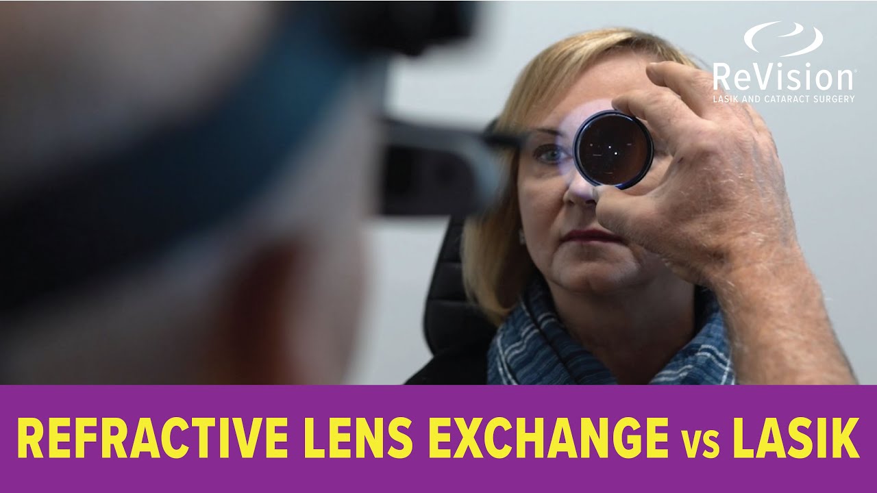 Benefits of Refractive Lens Exchange vs LASIK - YouTube