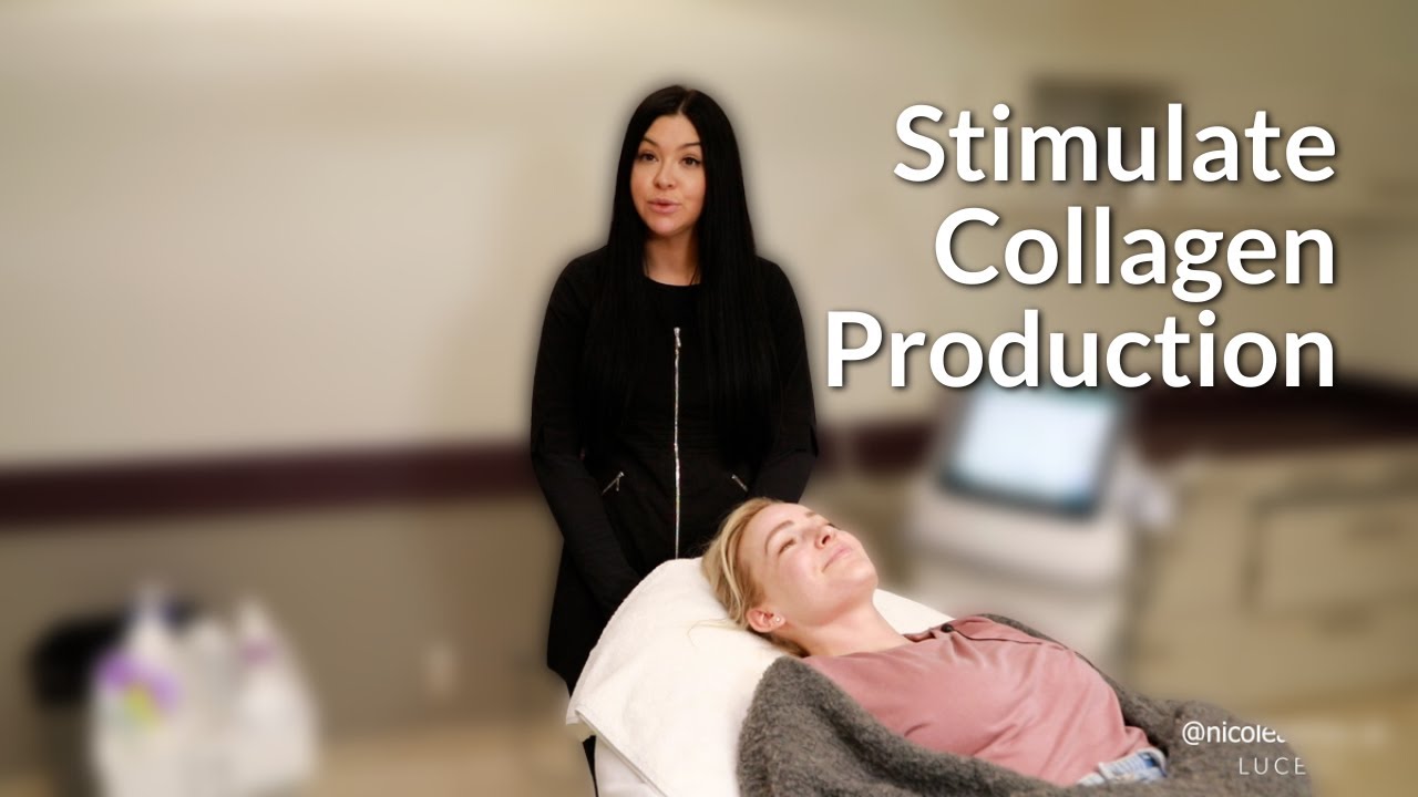 Transform Your Skin with Potenza RF Microneedling - See the Amazing ...