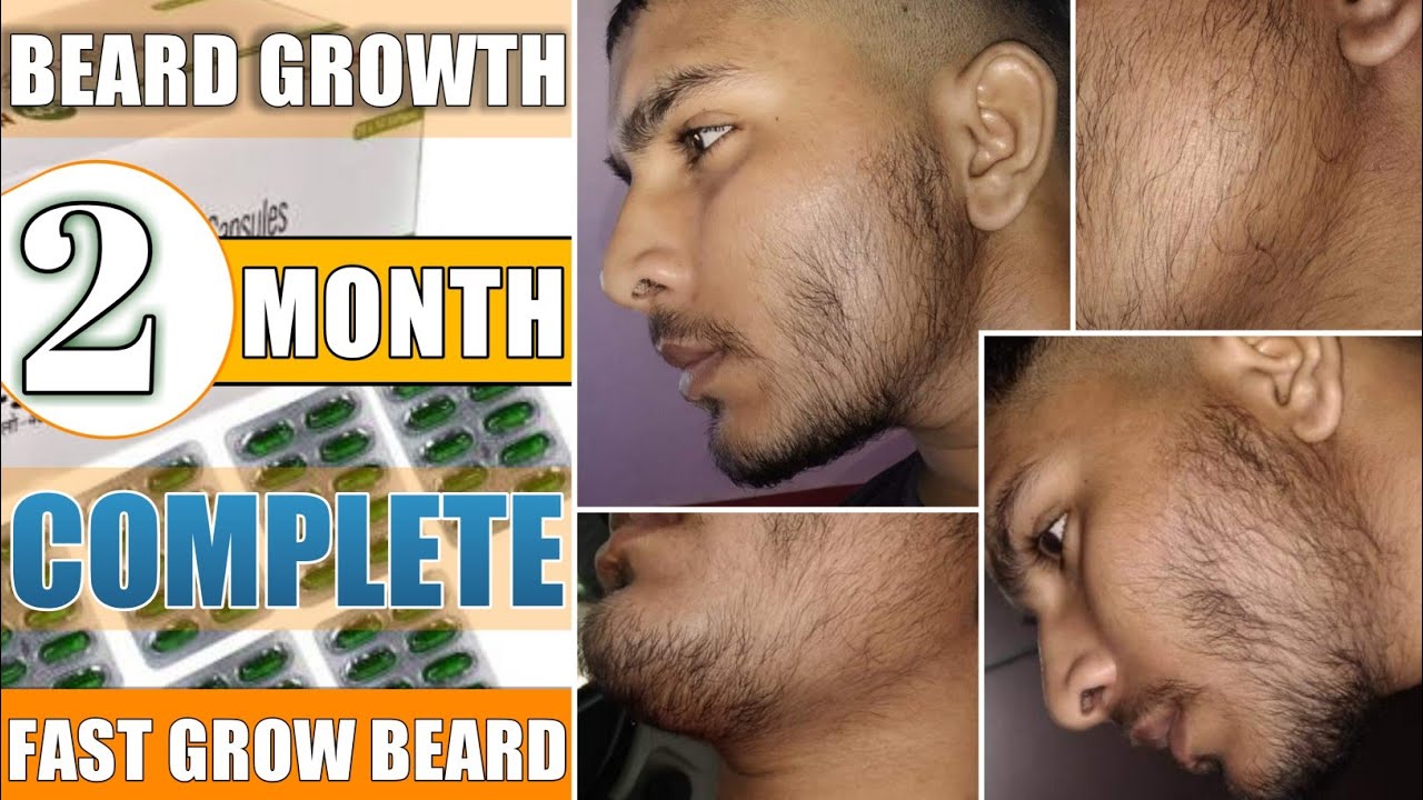 BEARD GROWTH 🔥 2 MONTH COMPLETE || FAST BEARD GROWTH || 2 महीने में ...