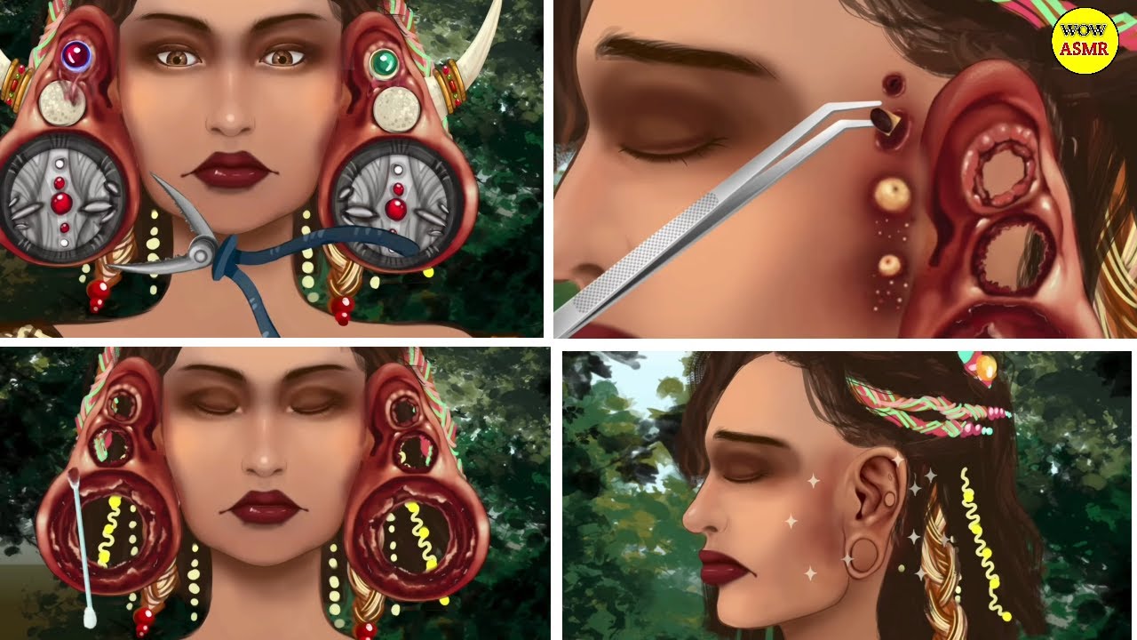 Earring infection asmr satisfying treatment asmr animation #animation # ...
