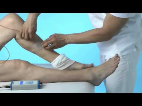 Therapy of Ulcus Cruris Venosum - English - YouTube