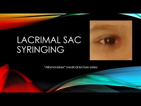 Lacrimal sac syringing crystal clear explaination - YouTube