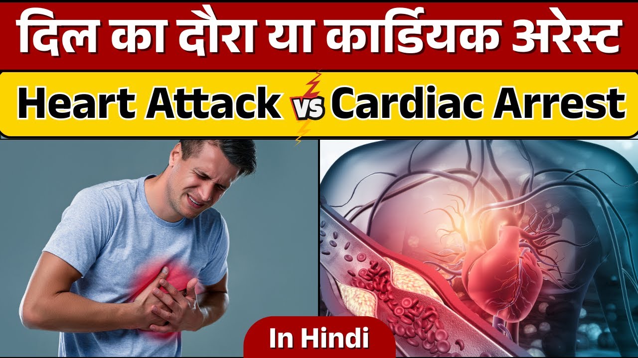 Heart Attack vs Cardiac Arrest — Difference, Signs & What To Do (CPR ...