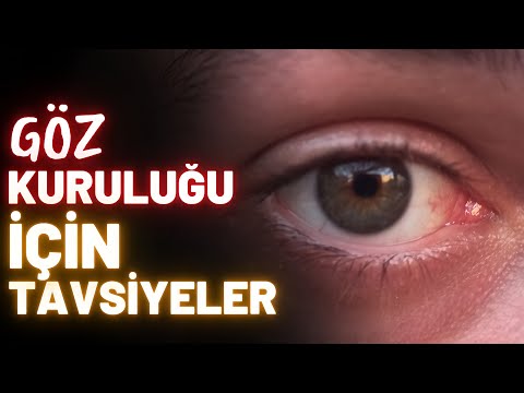 GÖZ KURULUĞUNA NE İYİ GELİR -  GÖZ KURULUĞU BELİRTİLERİ - HACAMATIN FAYDALARI