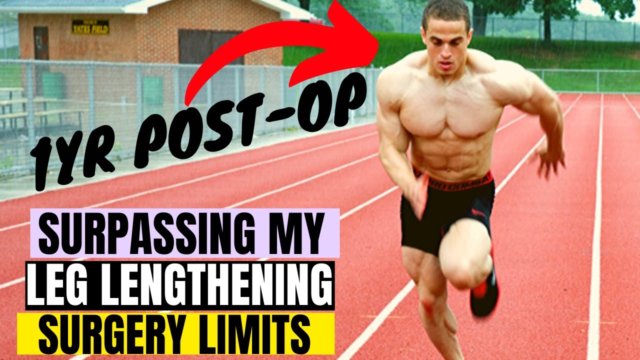 Squatting, Running, Agility, Jumping after Limb Lengthening Surgery ...