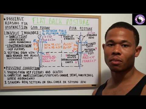Flat Back Posture Causes and Corrections - YouTube