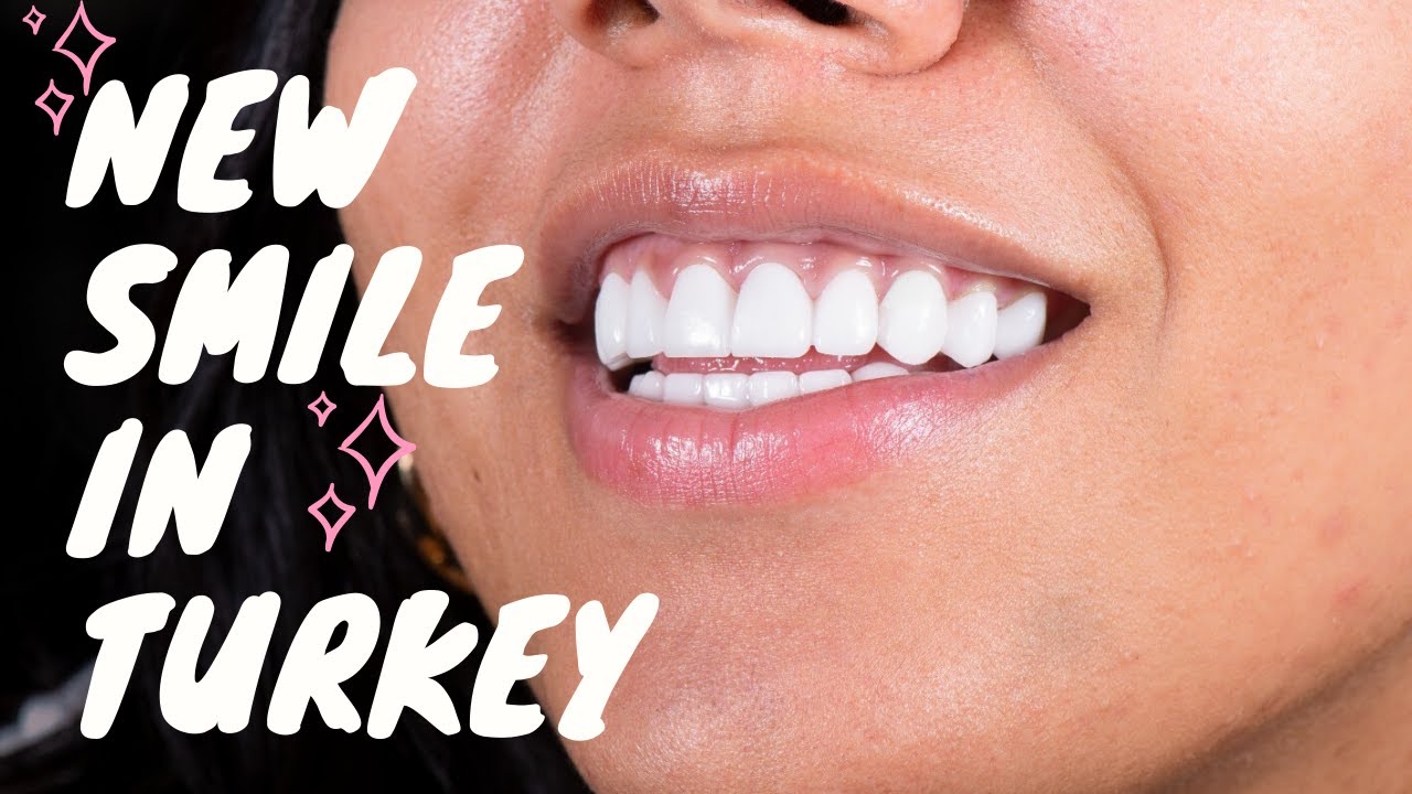 MY SMILE IN TURKEY! - My Veneer Smile Dental Clinic - YouTube