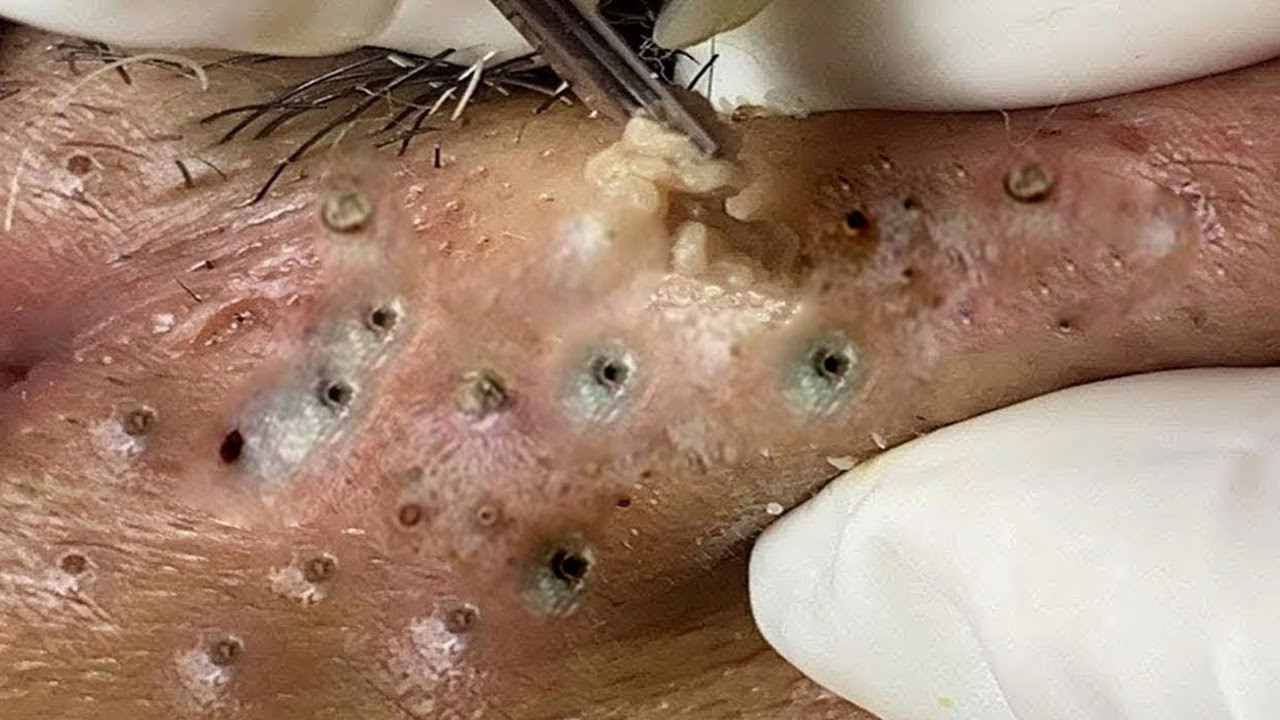 𝐑𝐞𝐟𝐫𝐞𝐬𝐡 𝐘𝐨𝐮𝐫 𝐅𝐚𝐜𝐞 𝐖𝐢𝐭𝐡 𝐒𝐤𝐢𝐧 𝐂𝐚𝐫𝐞 #𝟓𝟑𝟔𝟎345 - YouTube