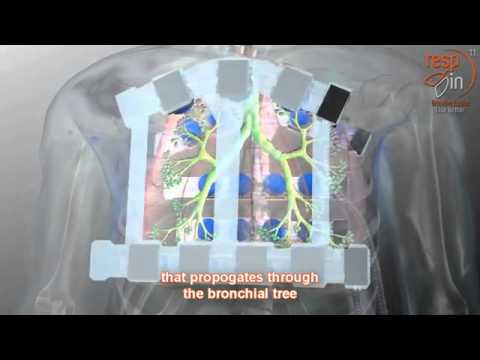 RespIn 11 Bronchial Clearance System Animation - YouTube