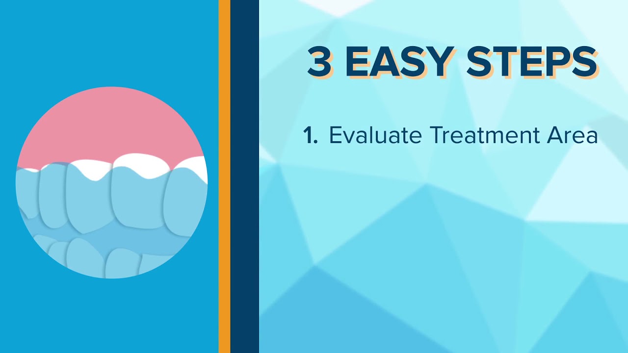 Excellerator - For Great Smiles - Dr. Lofgren & Dr. Ghosh - YouTube