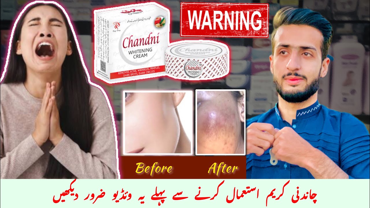 Chandni Whitening Cream | Honest Review about Chandani Whitening Cream ...