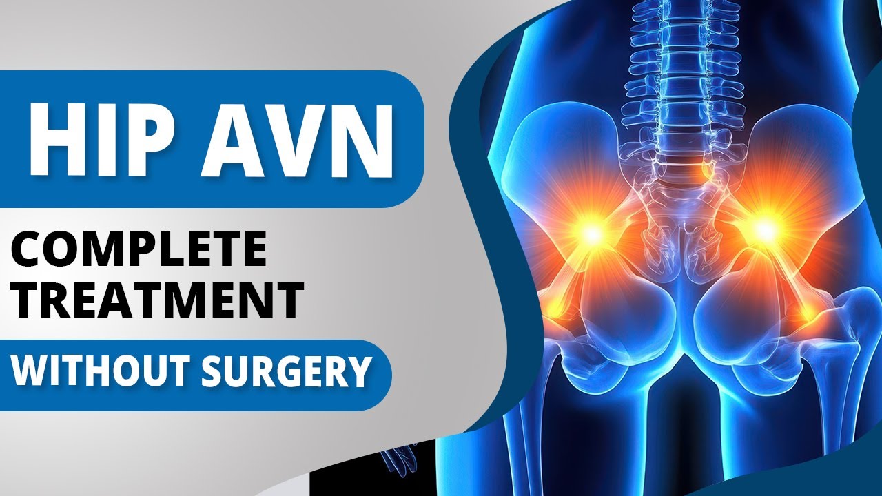 HIP AVN Complete treatment without Surgery - Part 1 #hip #avn #hipavn # ...