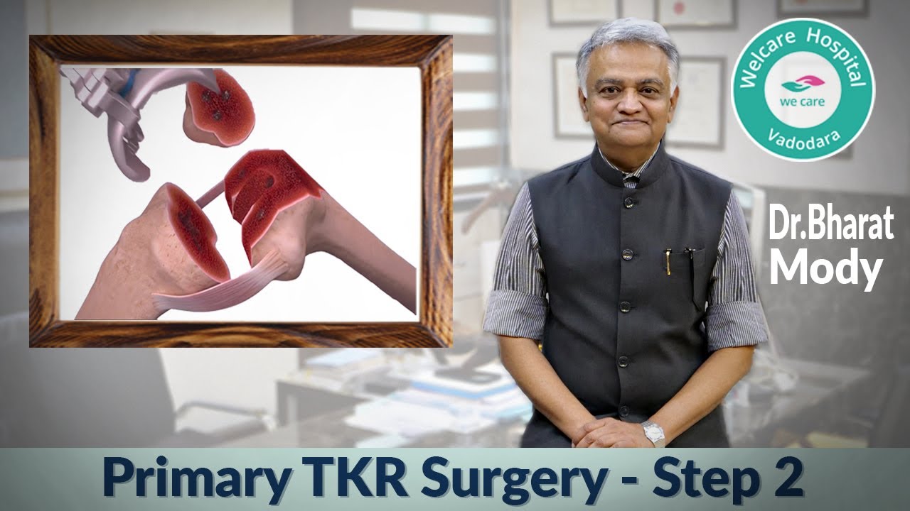 4) LECTURE - 4 PRIMARY TKR SURGERY Part - 2 - YouTube