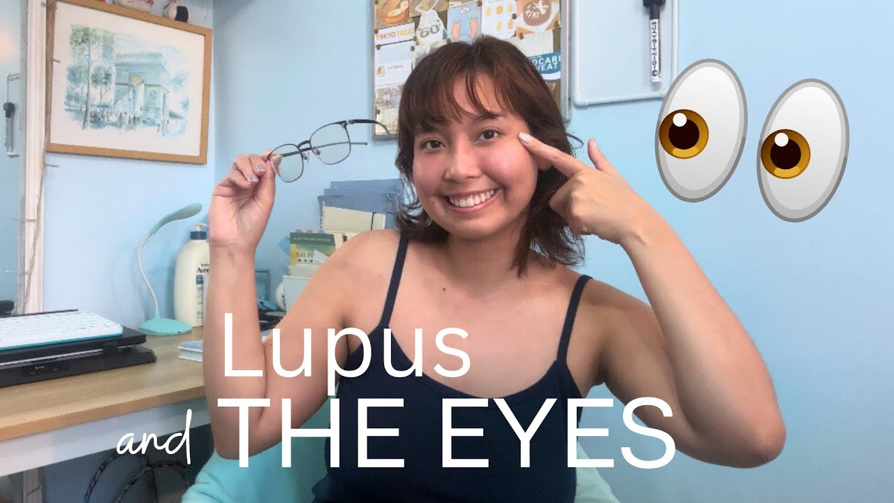 👀 Lupus and the Eyes: Common Eye Issues and Prevention! - Lupus Diaries ...