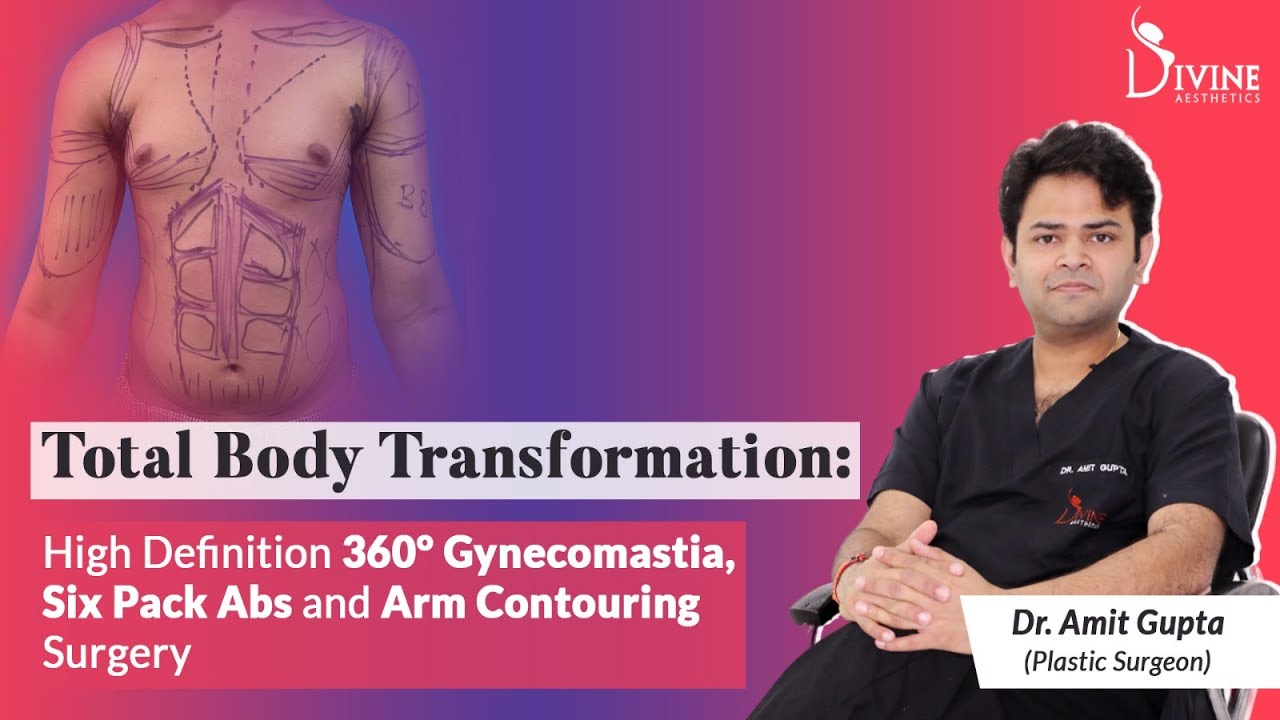 Total Body Transformation: High Definition 360 Gynecomastia, Six Pack ...