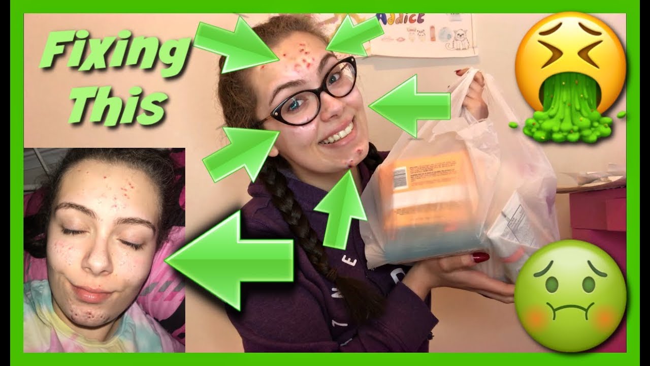 Finally Taking Care of My Gross Skin (Affordable Skincare Haul) - YouTube