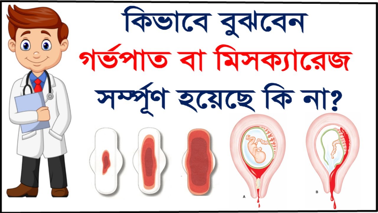 পুরোপুরি গর্ভপাত না হওয়ার লক্ষণ। How to know if abortion is complete ...