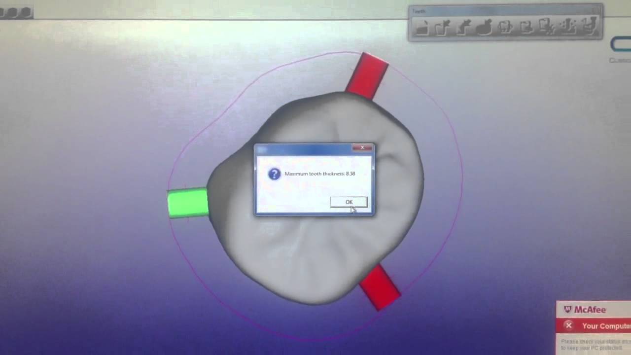Open InLab .stl export for InLab 4.0 - YouTube