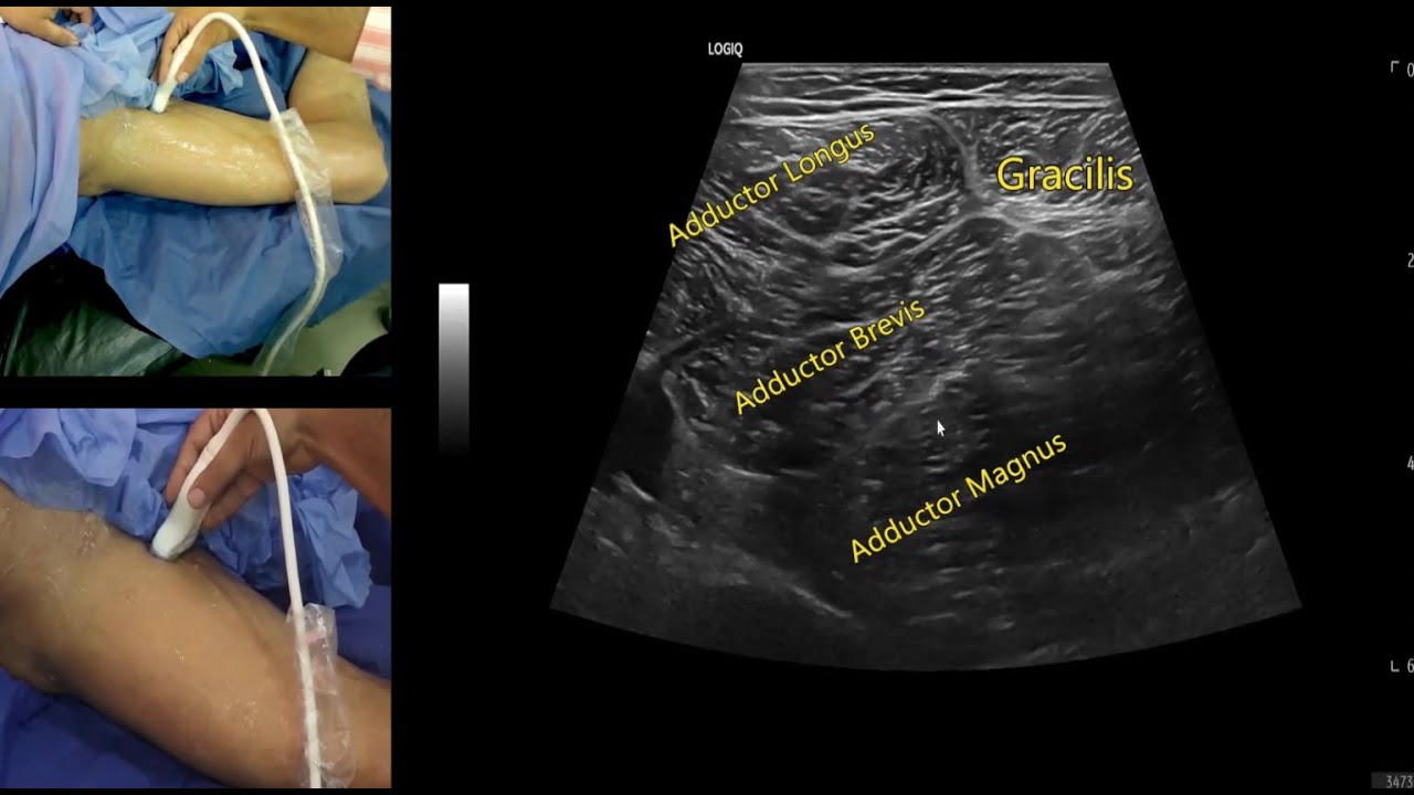 The Ultimate MSK Ultrasound Atlas - YouTube