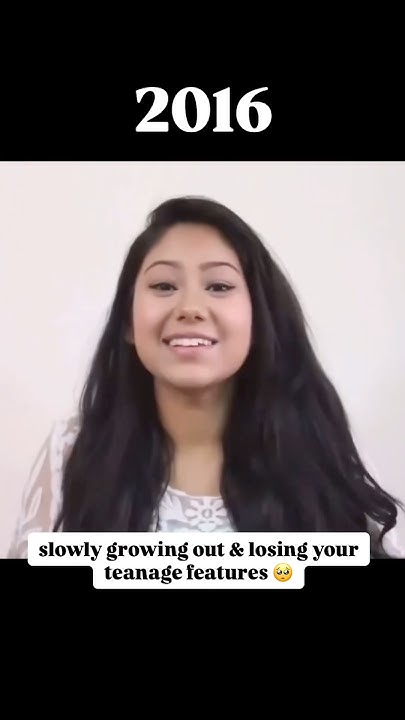 Slowly Losing My Teenage Features 🥹The 1-Week Skincare Transformation ...