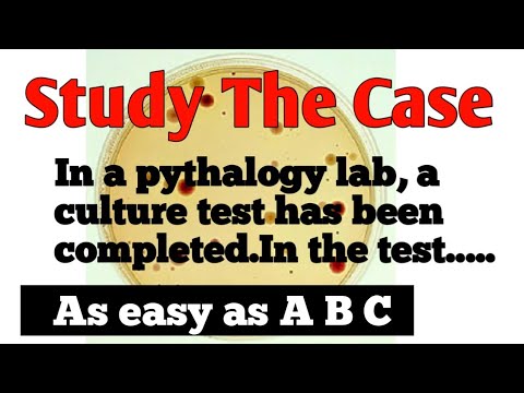 HOW TO SOLVE CASE BASED QUESTION ? ITS AS EASY AS 👉A 👉B👉C - YouTube