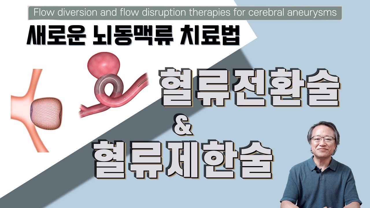 [뇌동맥류] 새로운 뇌동맥류 치료법 두 가지: 혈류전환술과 혈류제한술 (Flow diversion and disruption ...
