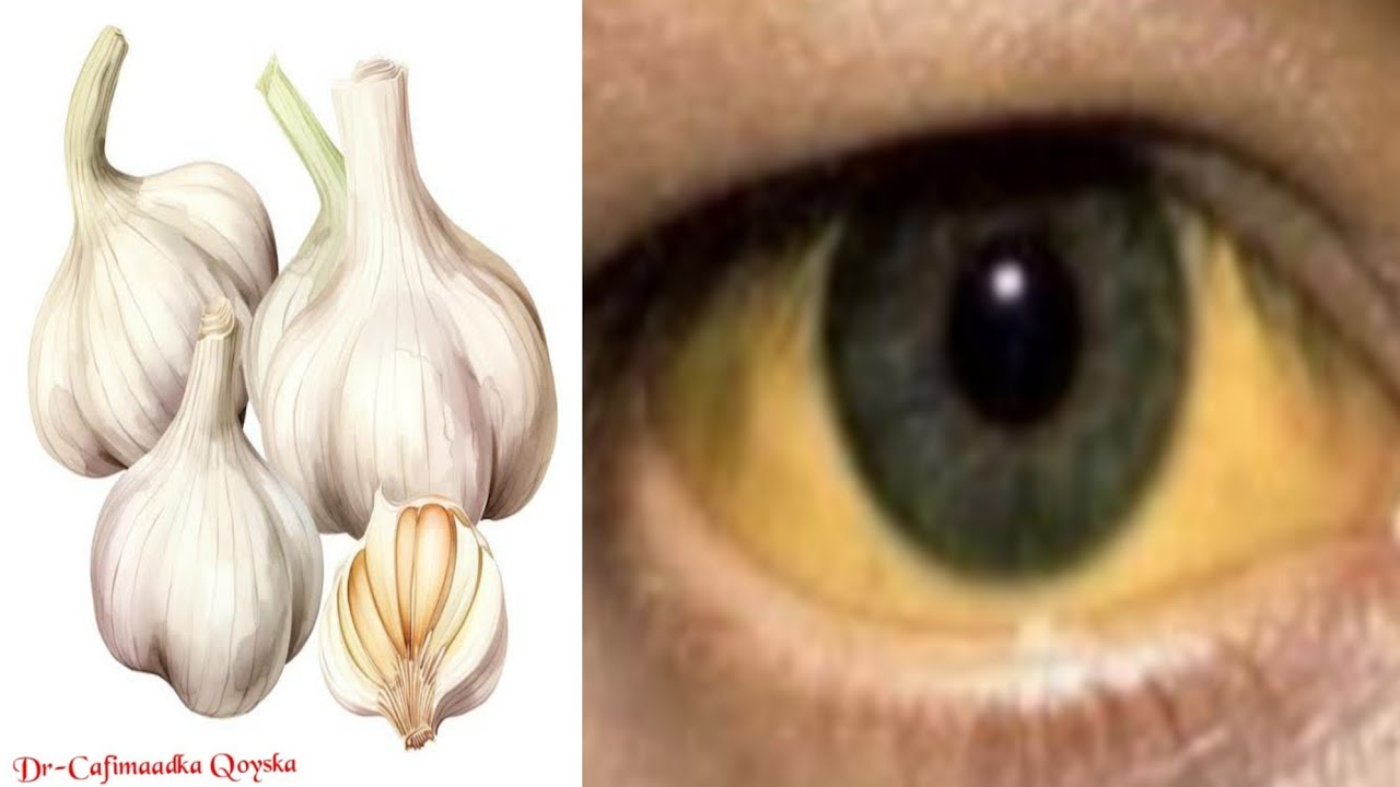 5-da Xanuun Ee Laga Qaado Toonta👀👆 - YouTube