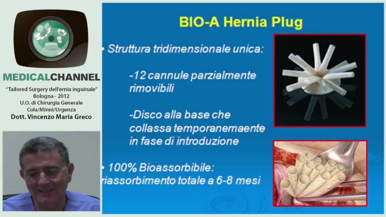 Mesh & Plug - YouTube