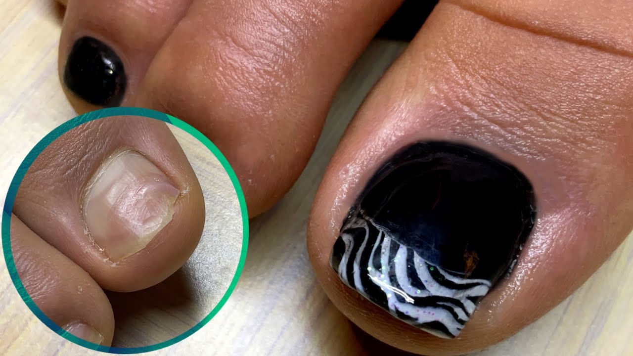 ToeNail Extension |Pedicure Time | New Appling on ToeNail| Nail Design ...