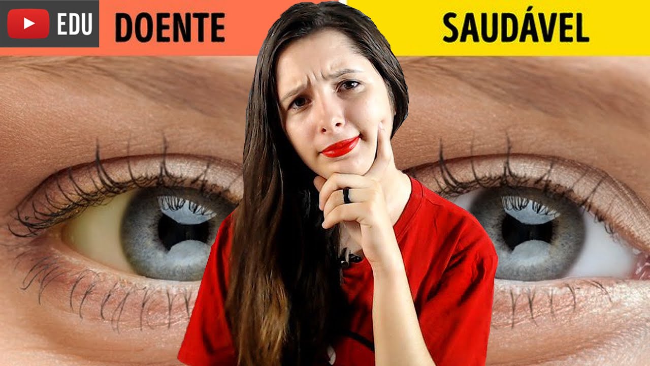 10 SINAIS QUE VOCÊ TEM ANEMIA - SERÁ QUE VOCÊ É ANÊMICO? - YouTube